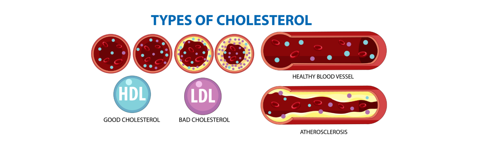 Understanding Cholesterol - Medicare Plus Inc.